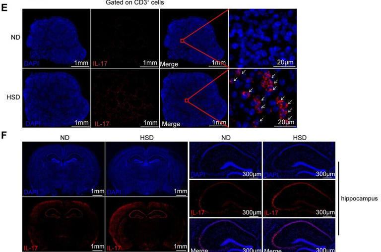 High-salt diet linked to depression: Protein IL-17A plays key role in ...