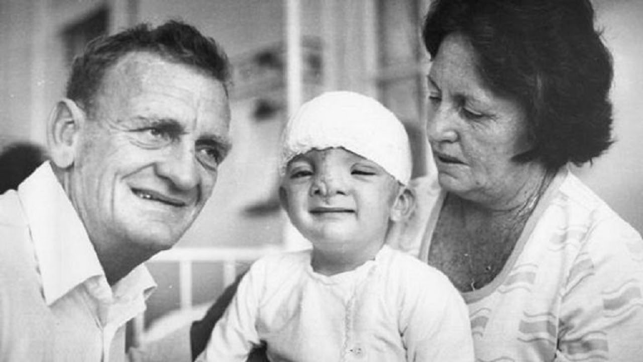 When This Newborn’s Mother First Saw His Severely Deformed Face, She ...