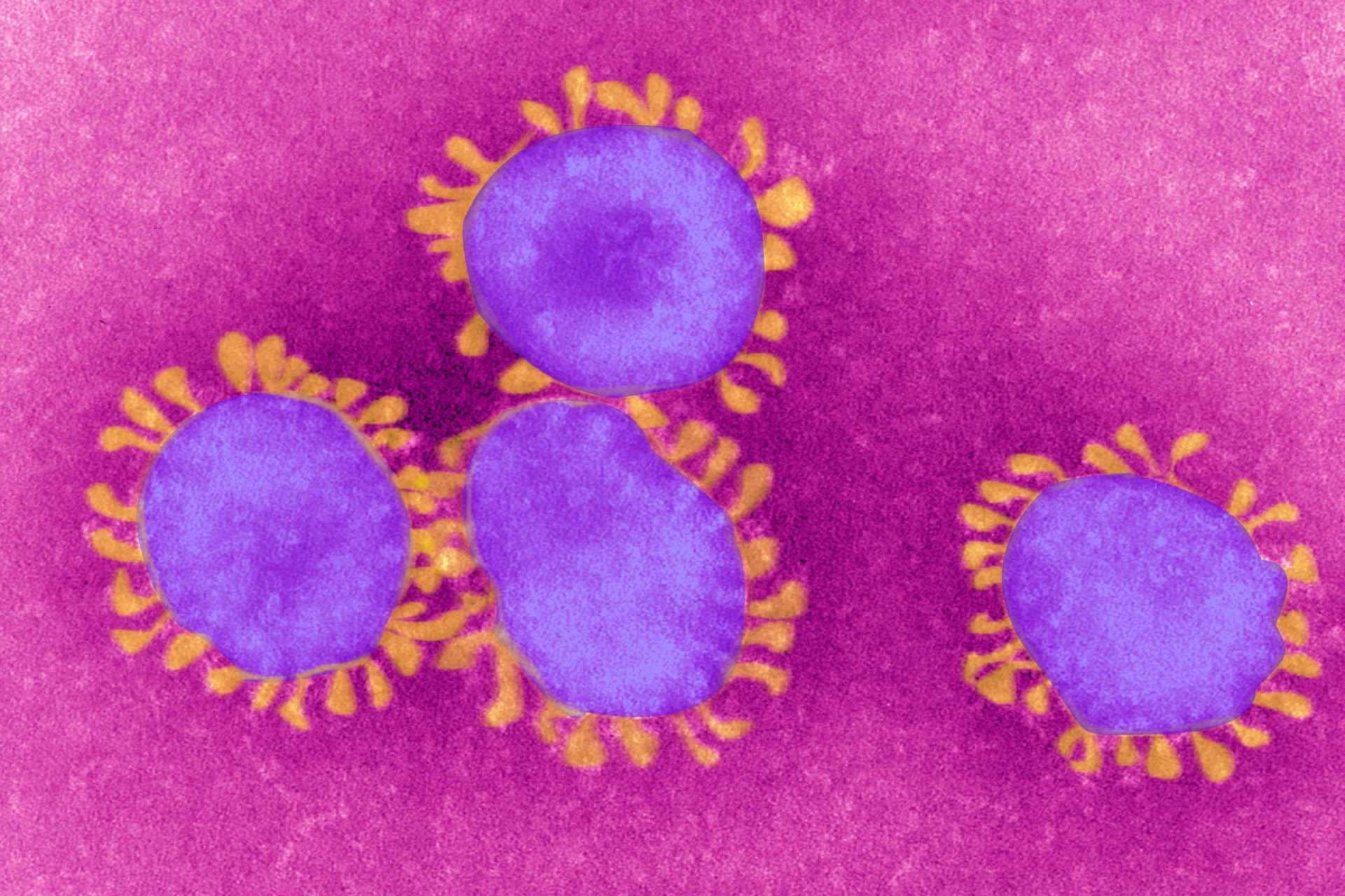 List of viruses that pose biggest threat to public health released