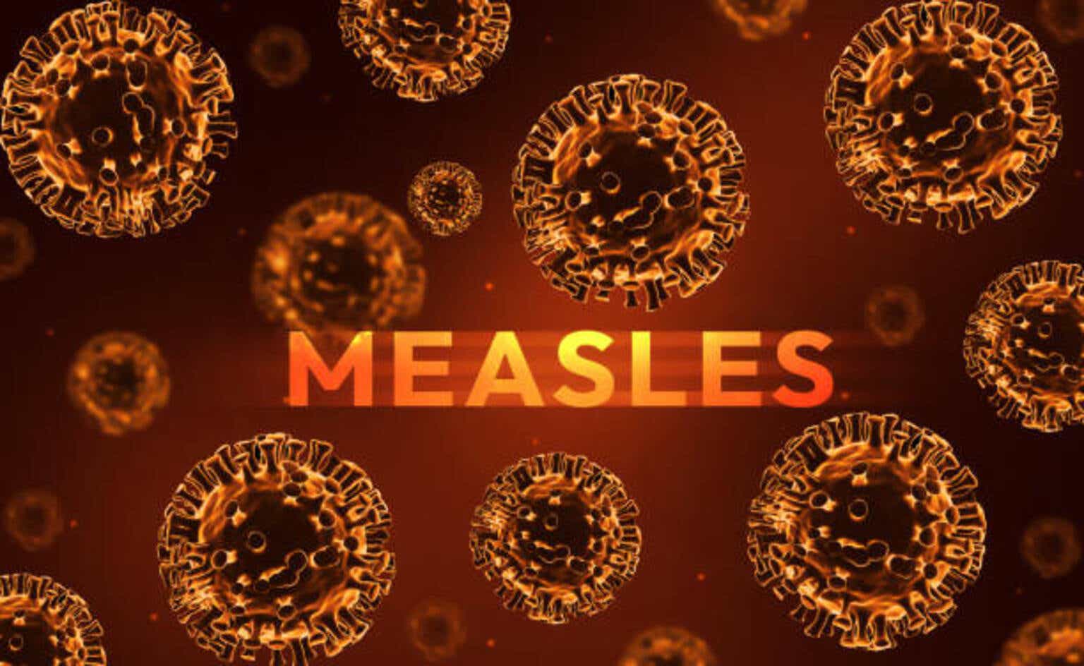 U.S. measles outbreak claims second death as RFK Jr. touts vaccines