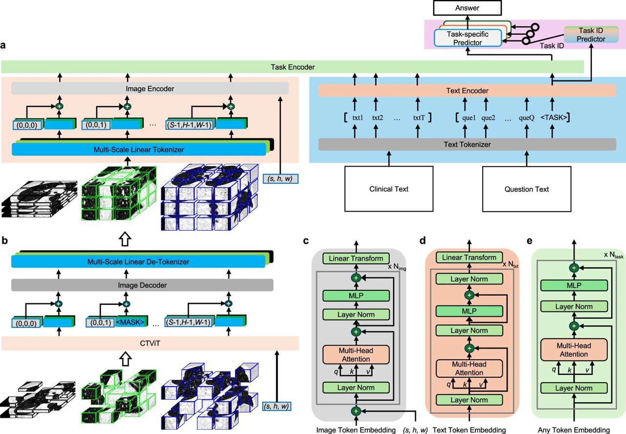 Multimodal multitask foundation model enhances lung cancer screening ...