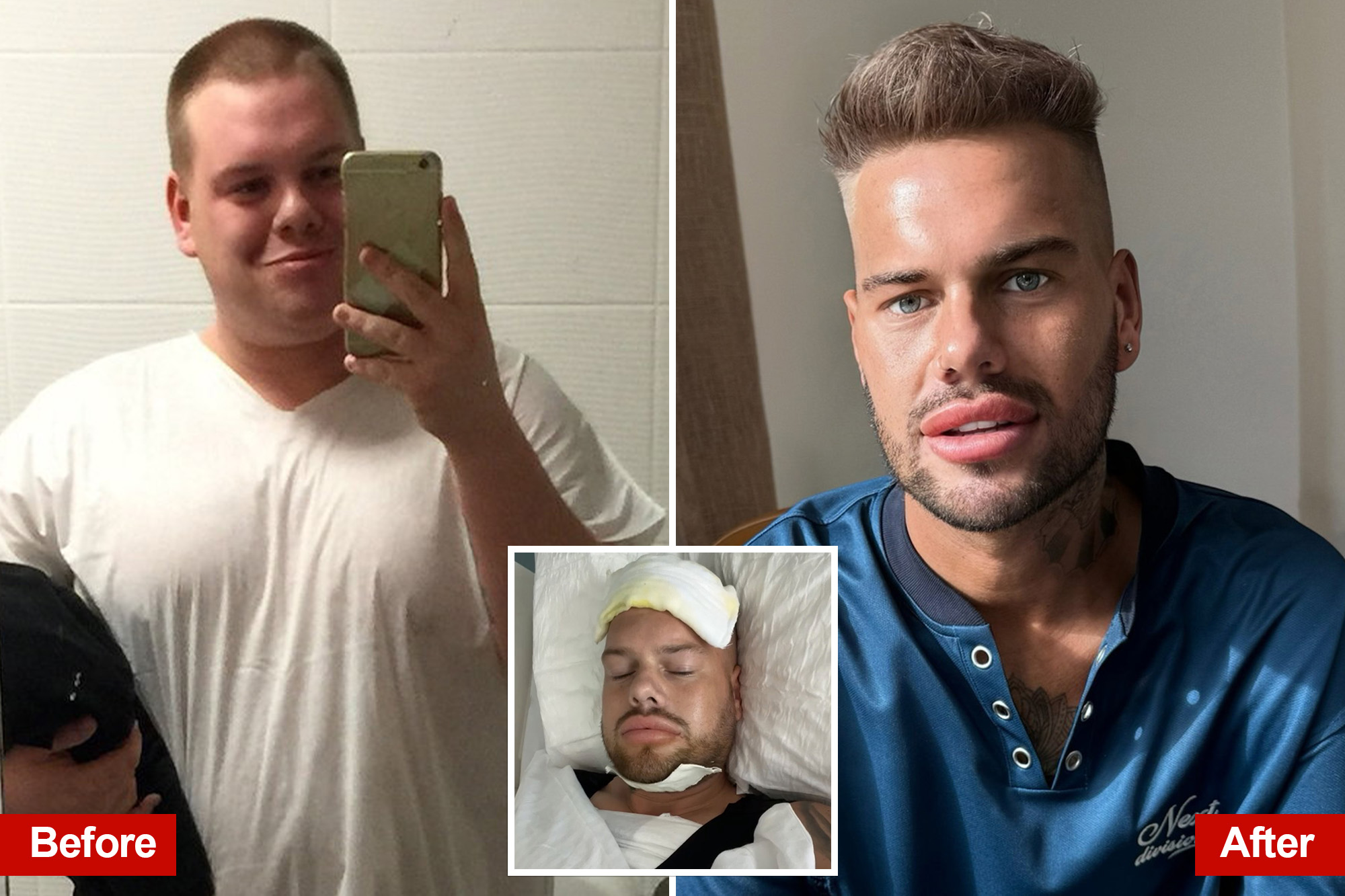 I wanted to look like an Instagram filter — so I spent over $46K on ...