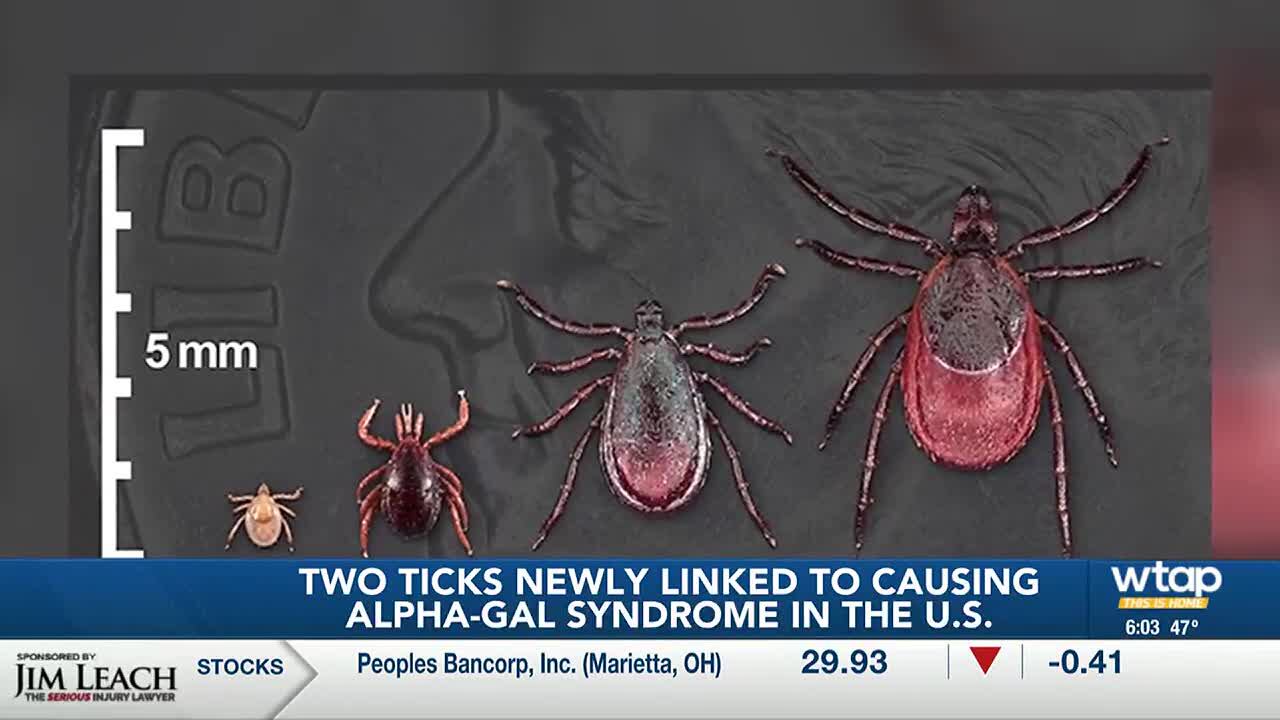 Two ticks newly linked to causing Alpha-Gal Syndrome in the United States