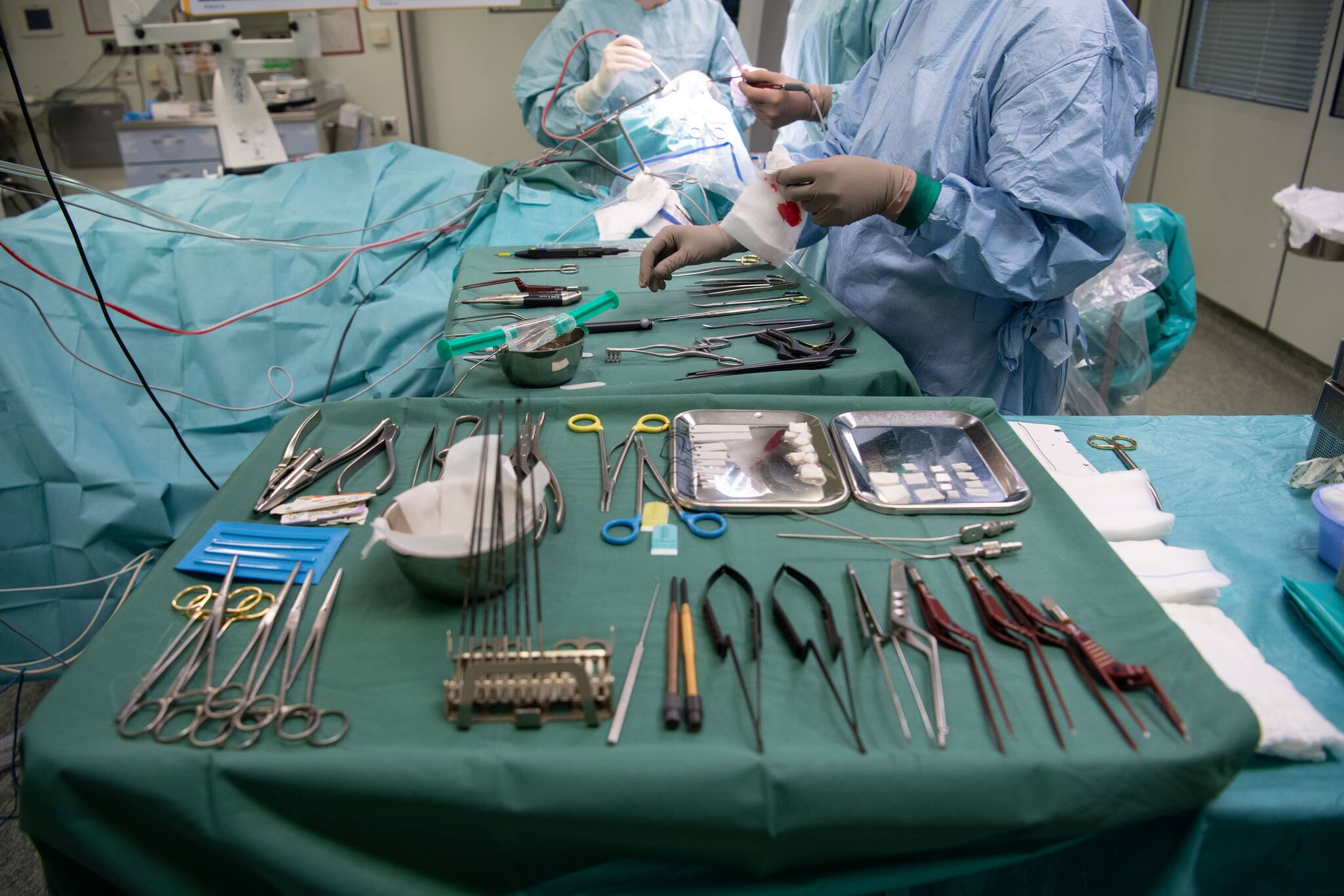 Schweineleber erstmals in hirntoten Menschen transplantiert