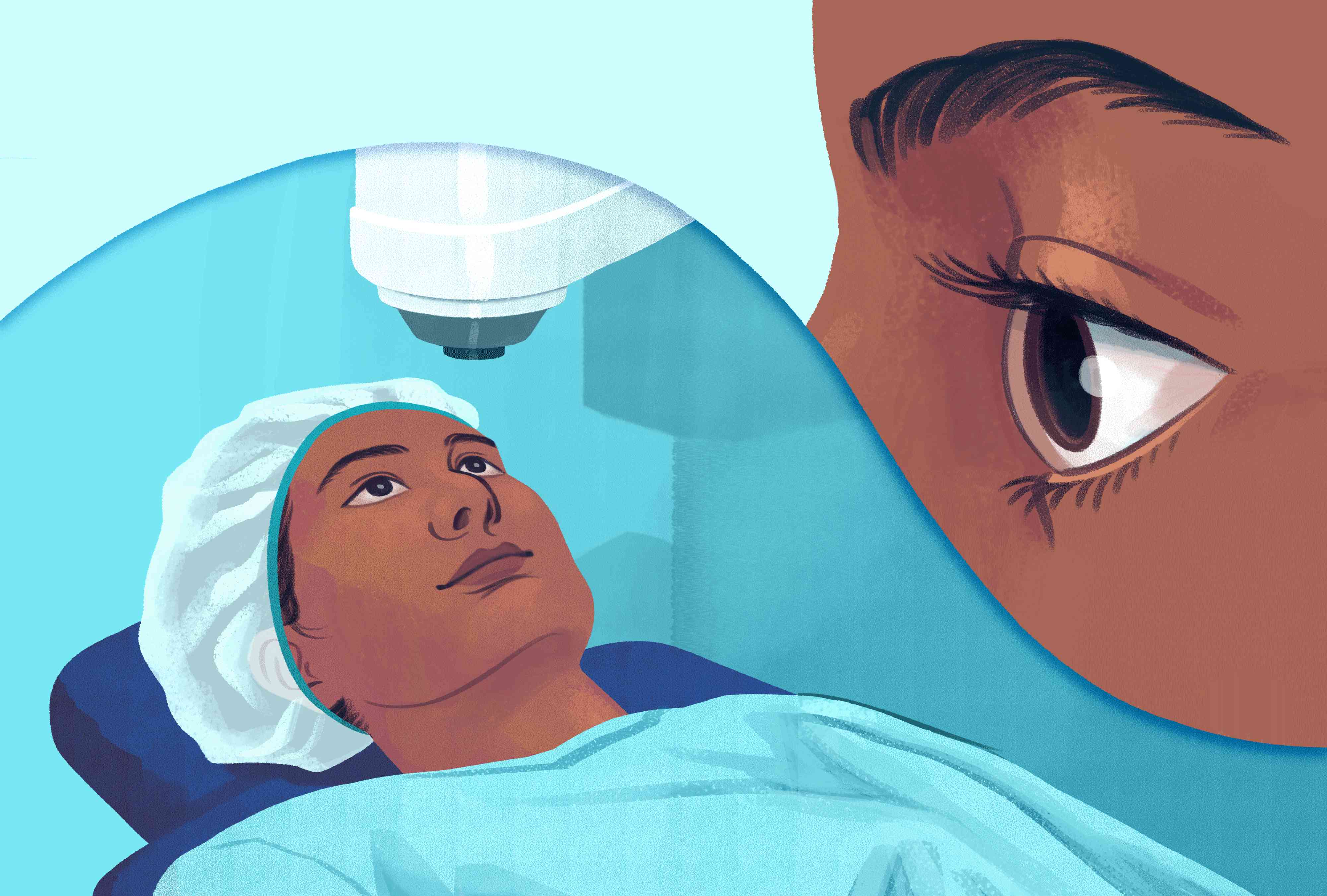 LASIK eye surgery: Factors to consider