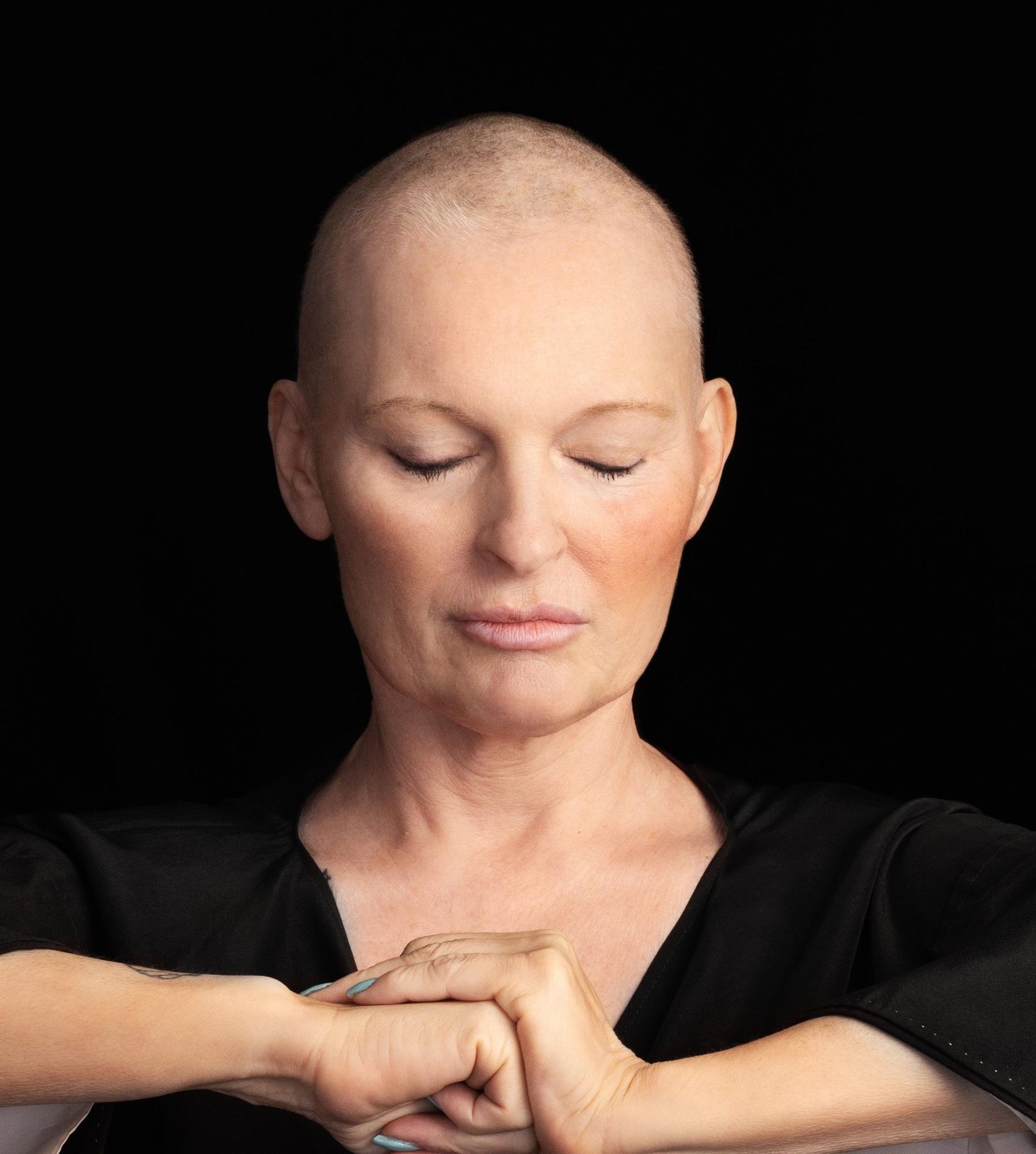 Pink Ribbon Foundation calls on bald Scottish women