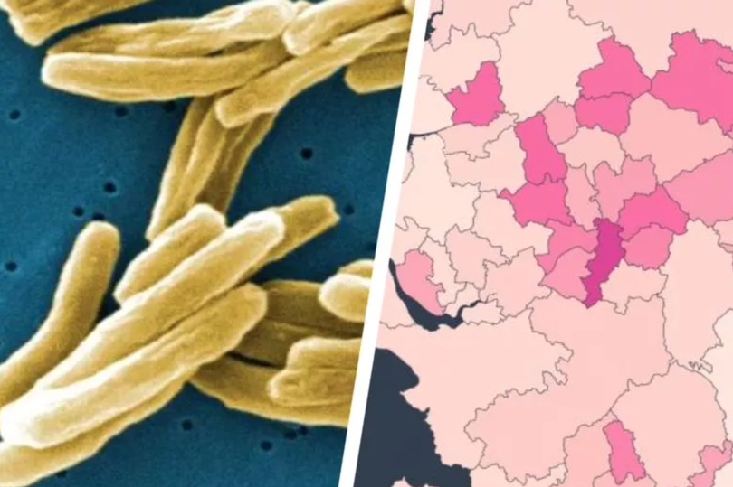Victorian superbug sweeps in as worrying hotspot identified as ...