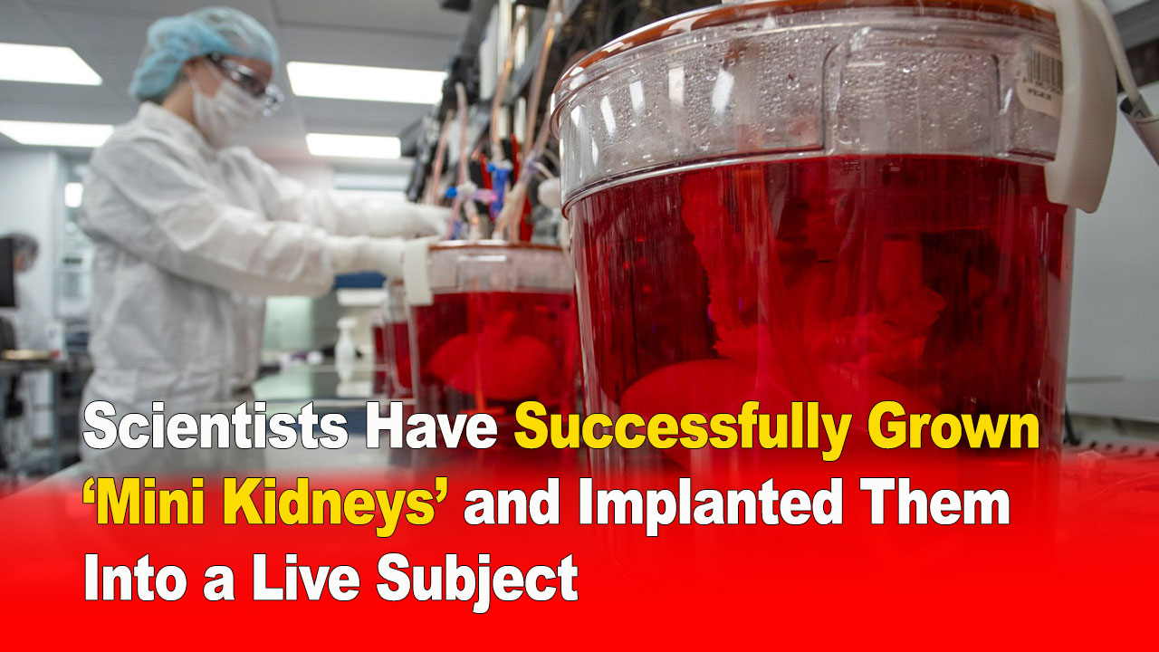 Scientists Have Successfully Grown ‘Mini Kidneys' and Implanted Them ...