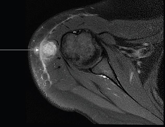 Woman contracts deadliest virus after being given the wrong vaccine