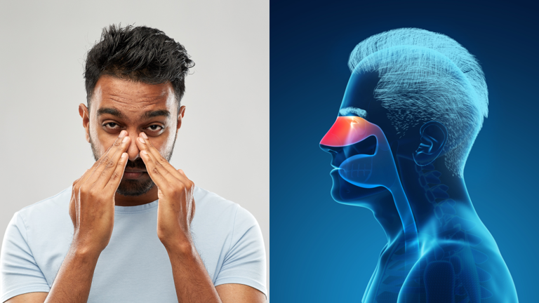 Struggling to Breathe Comfortably? Here’s How to Keep Your Nasal ...