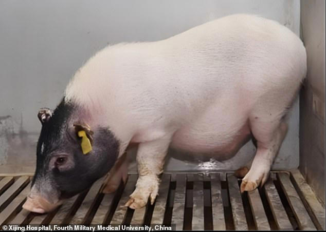 World's first pig to human liver transplant has been carried out
