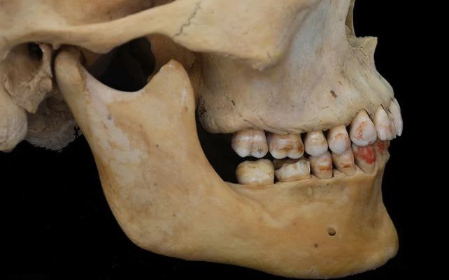 The Red Princess: Ancient Skeleton with Toxic Red Teeth Shocks ...
