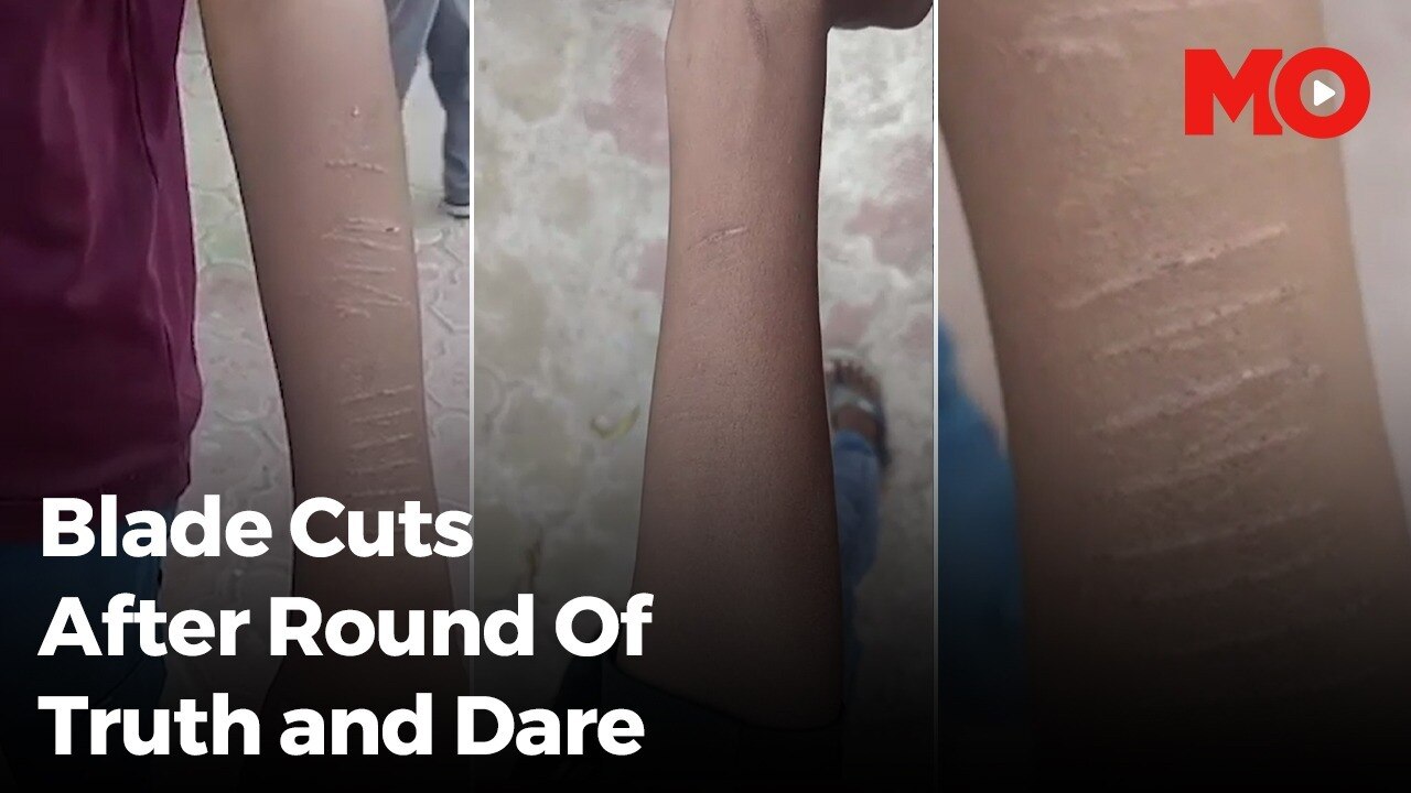 Gujarat school kids cut themselves with blades for a dare