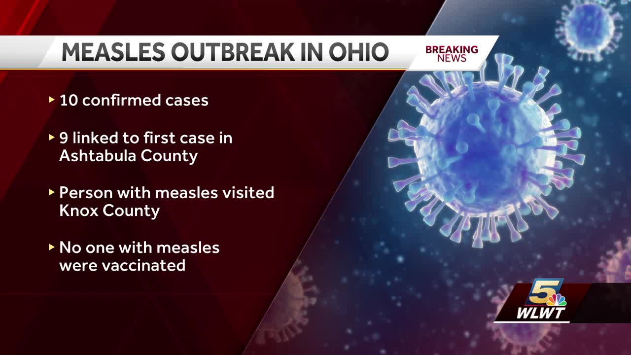 Health officials confirm measles outbreak in Ohio
