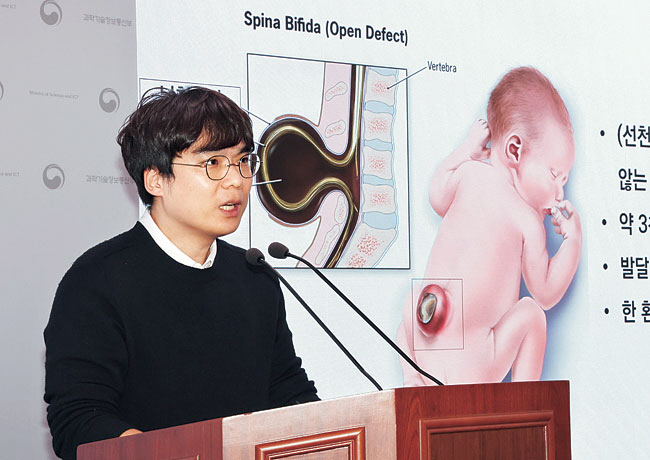 ‘3000명중 1명’ 보행장애 척추이분증… 한국인이 세계 첫 유전적 원인 찾았다