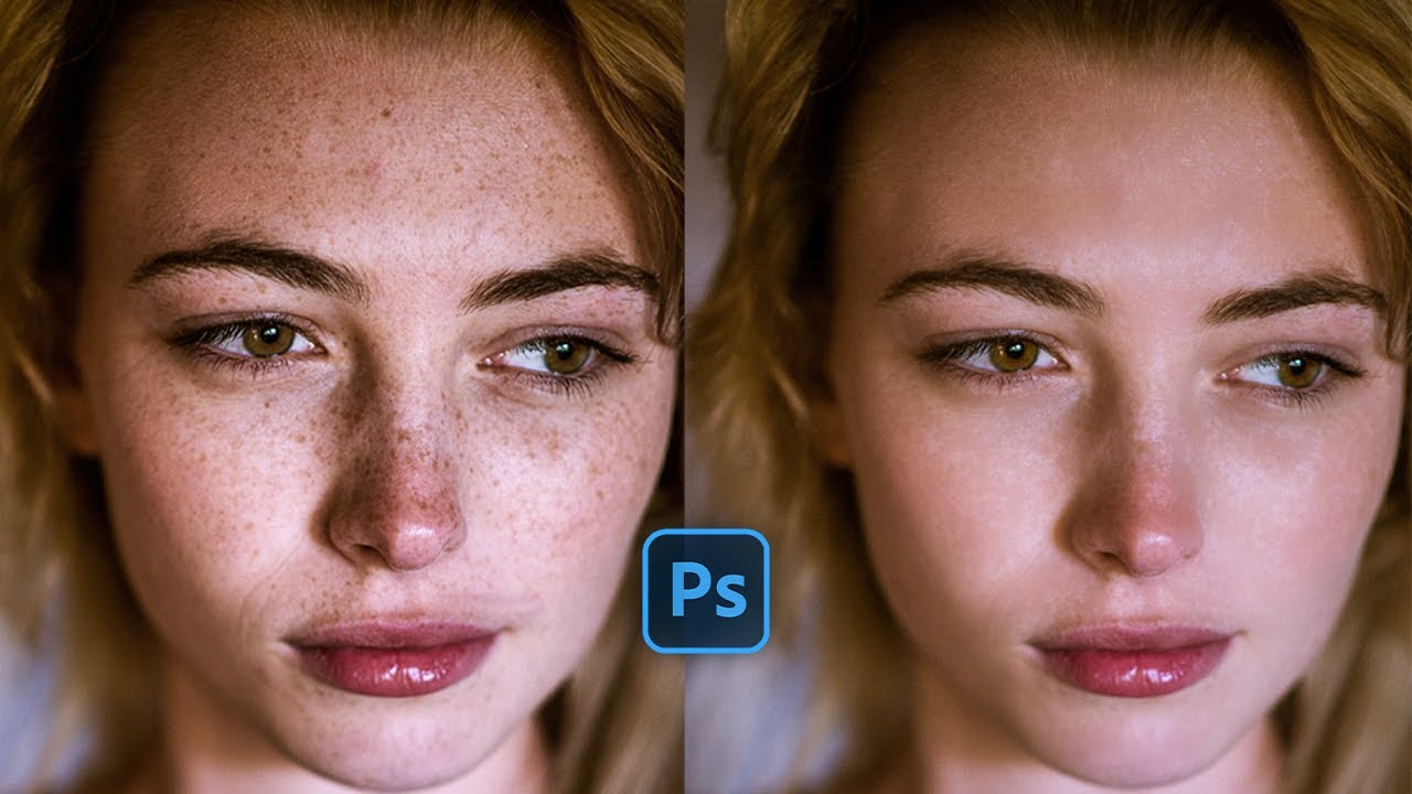 Photo Retouching Technique to Remove Freckles in Photoshop