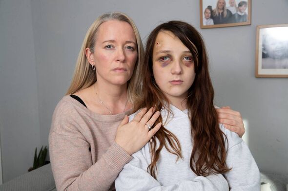 Girl, 16, admits beating autistic girl, 12, in grim skatepark attack