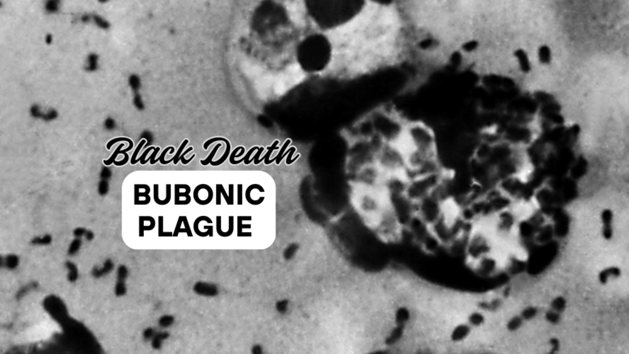 Has The Black Death Returned? List Of Dreadful Symptoms Of The Bubonic ...