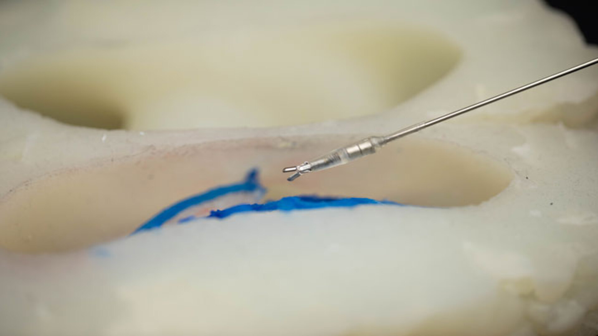 76% successful: Magnet-powered tiny robotic tools perform scalpel-free ...