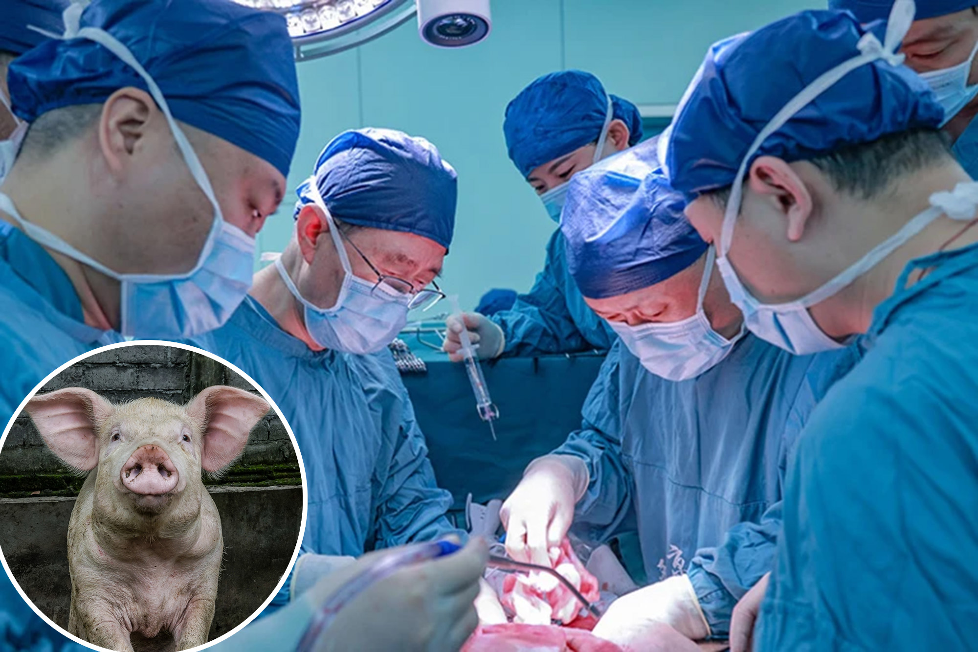 Chinese researchers successfully transplant pig kidney to human, take ...