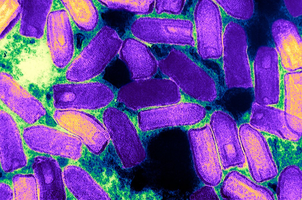 U.S. patient dies from rabies after organ transplant. Can this happen here?