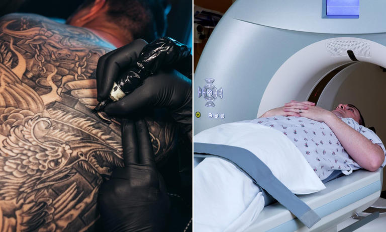 Experts discover people with tattoos are at double the risk of cancers