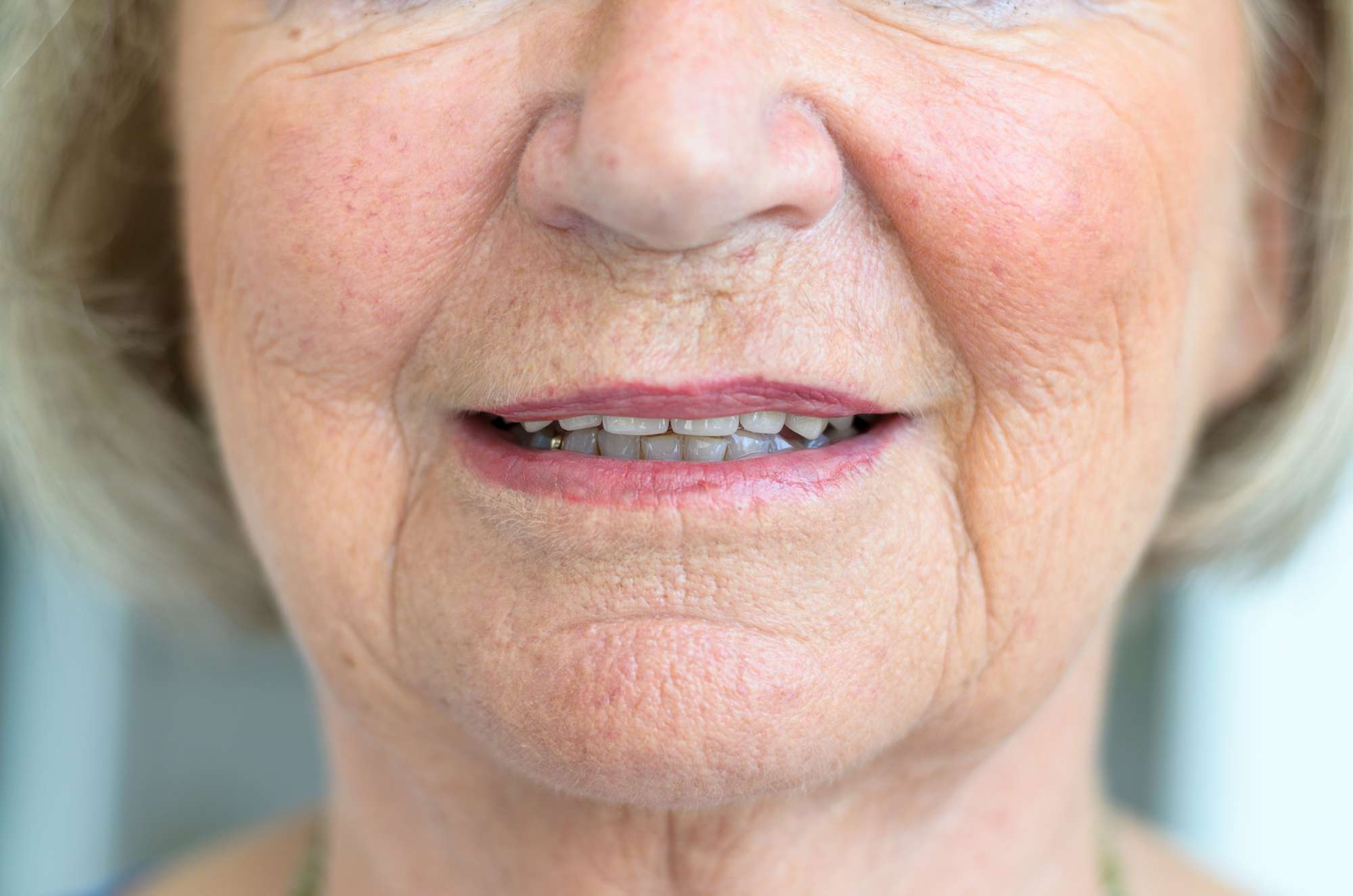 Why does my face feel hot? 11 causes