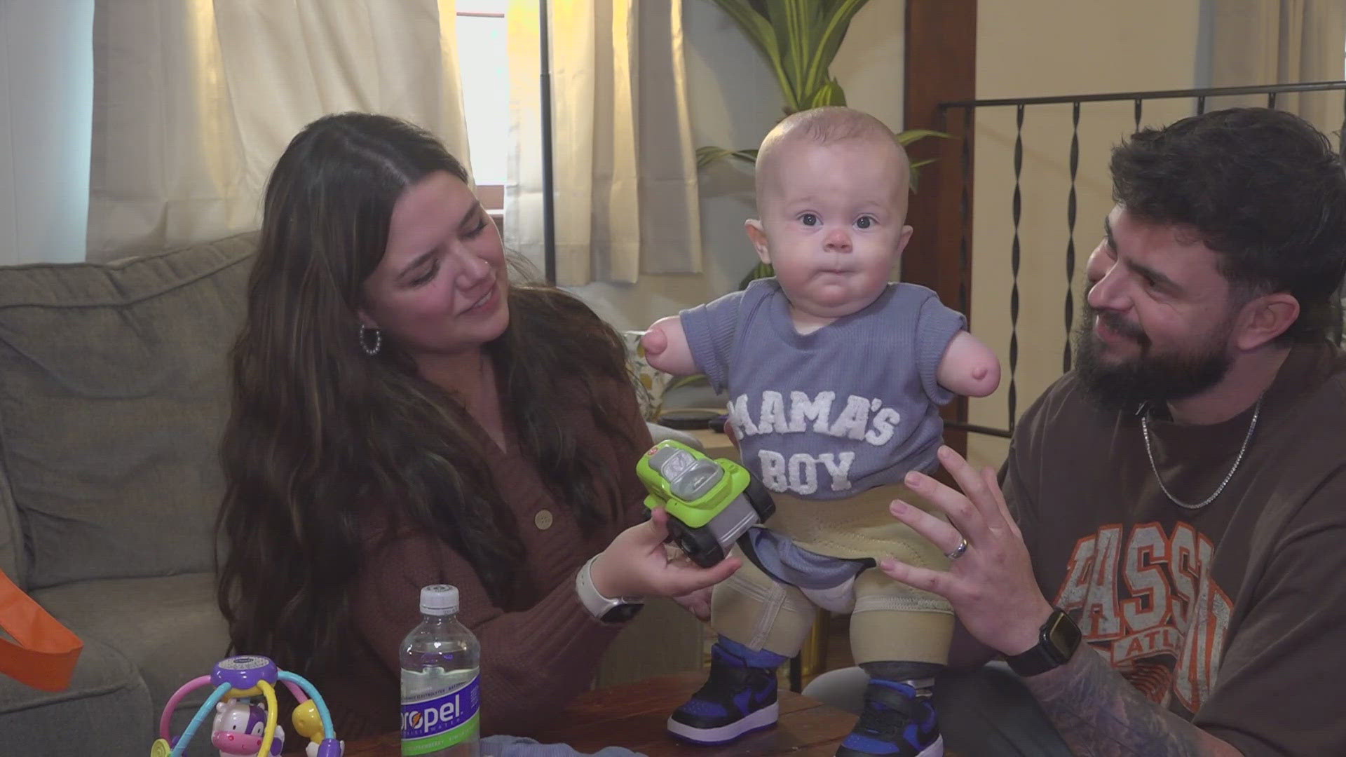 Baby born with no limbs gets prosthetic legs
