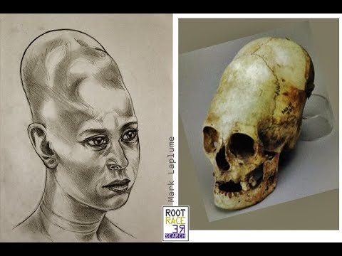 DNA Results Of The Paracas Elongated Skulls Of Peru; Part 5; More ...