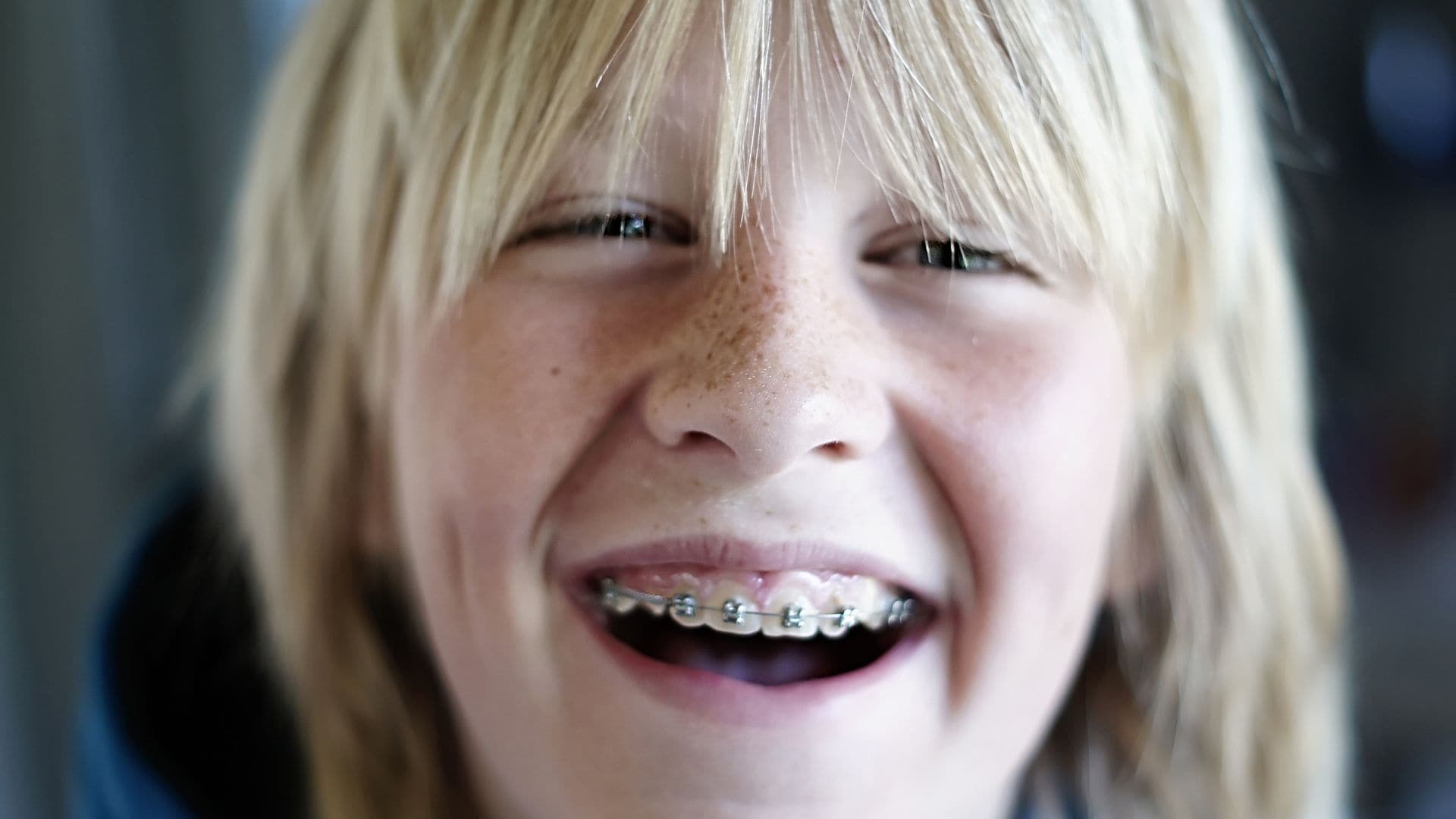 Así influye la ortodoncia en la salud y el bienestar de los adolescentes