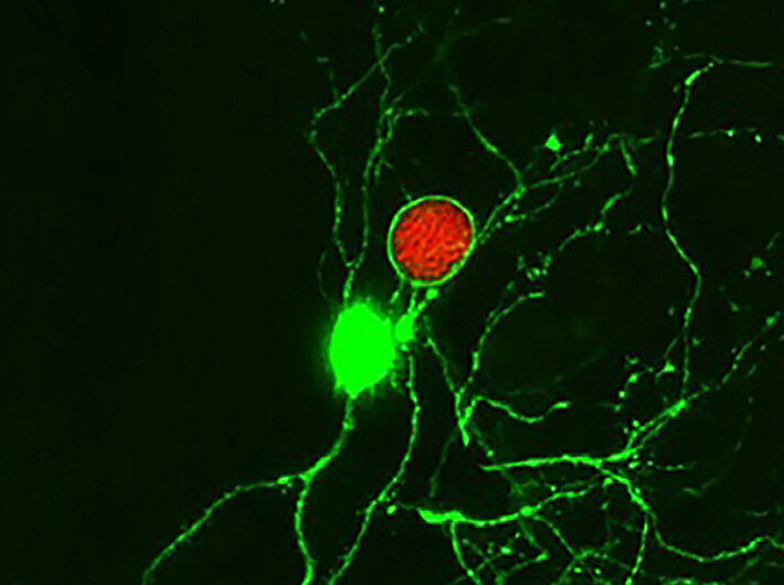 Understanding the immune response to Toxoplasma gondii, a persistent ...