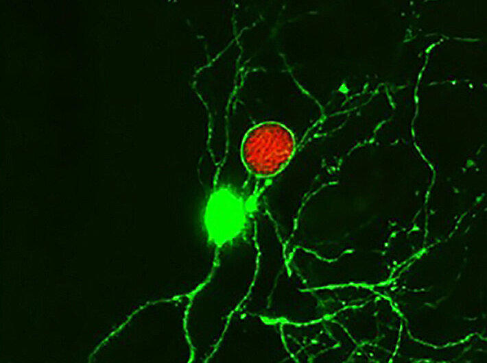 Understanding the immune response to Toxoplasma gondii, a persistent ...