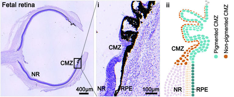 Human retinal stem-like cells with potential to repair vision loss ...