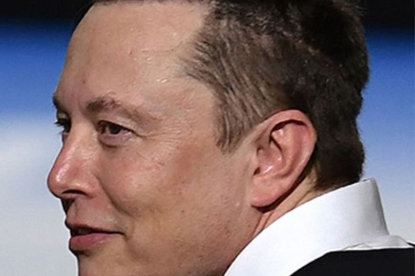 Alarming photos reveals Elon's Musk 'hair transplant scars'