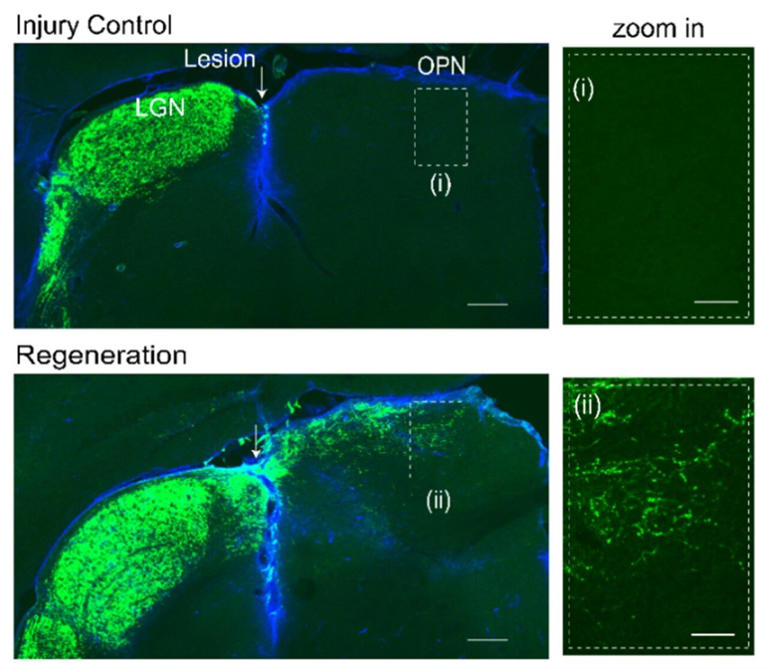 Innovative model shows how optic tract injuries can heal through axonal ...