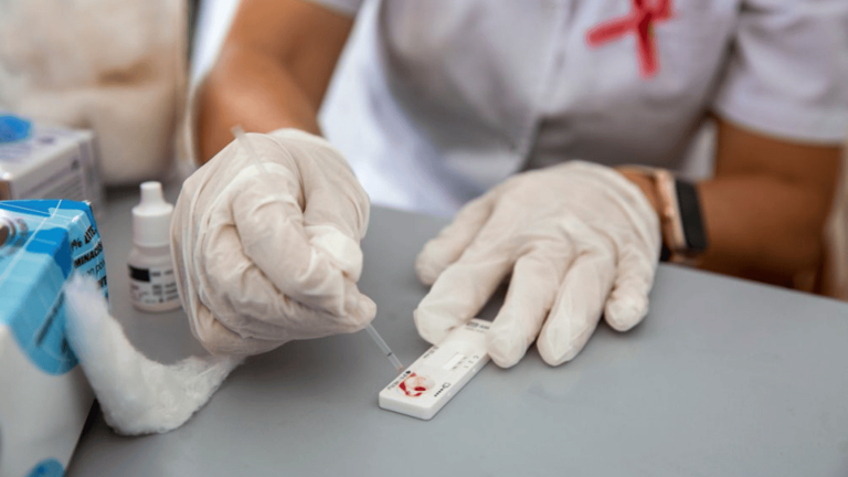 Del estigma a la ciencia: cuatro décadas de lucha contra el sida