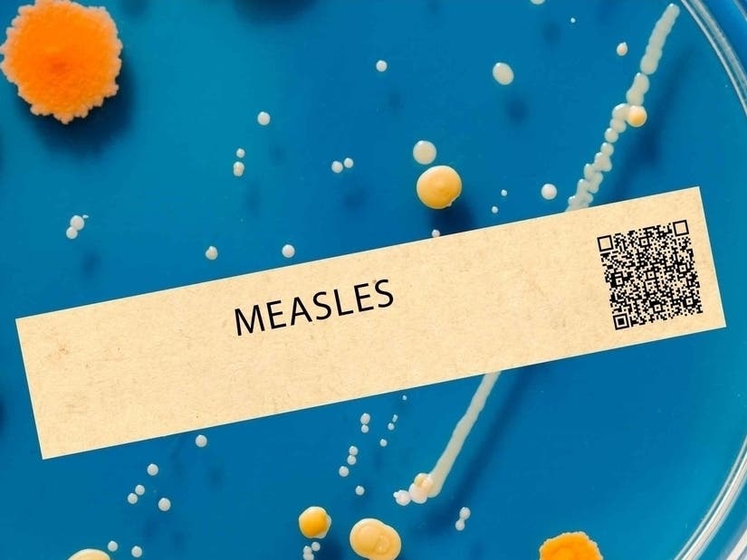 Possible Measles Exposure At Mercer Hospital, Health Officials Warn