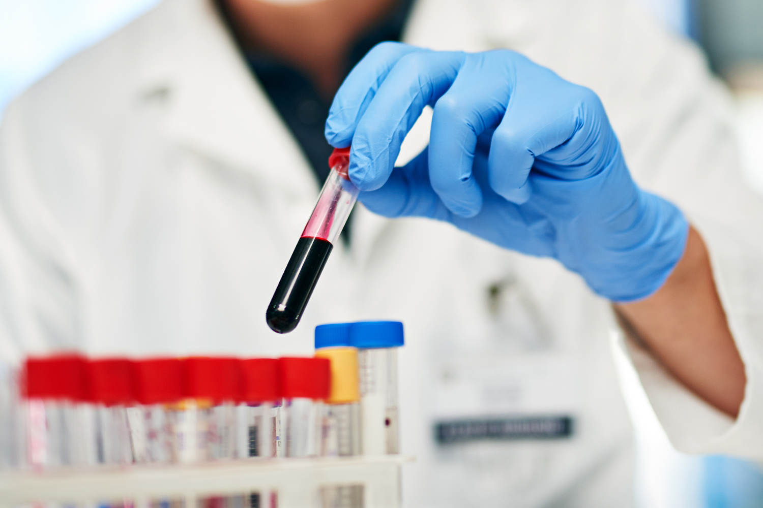 One dose of experimental drug nearly wipes out stealthy cholesterol in ...