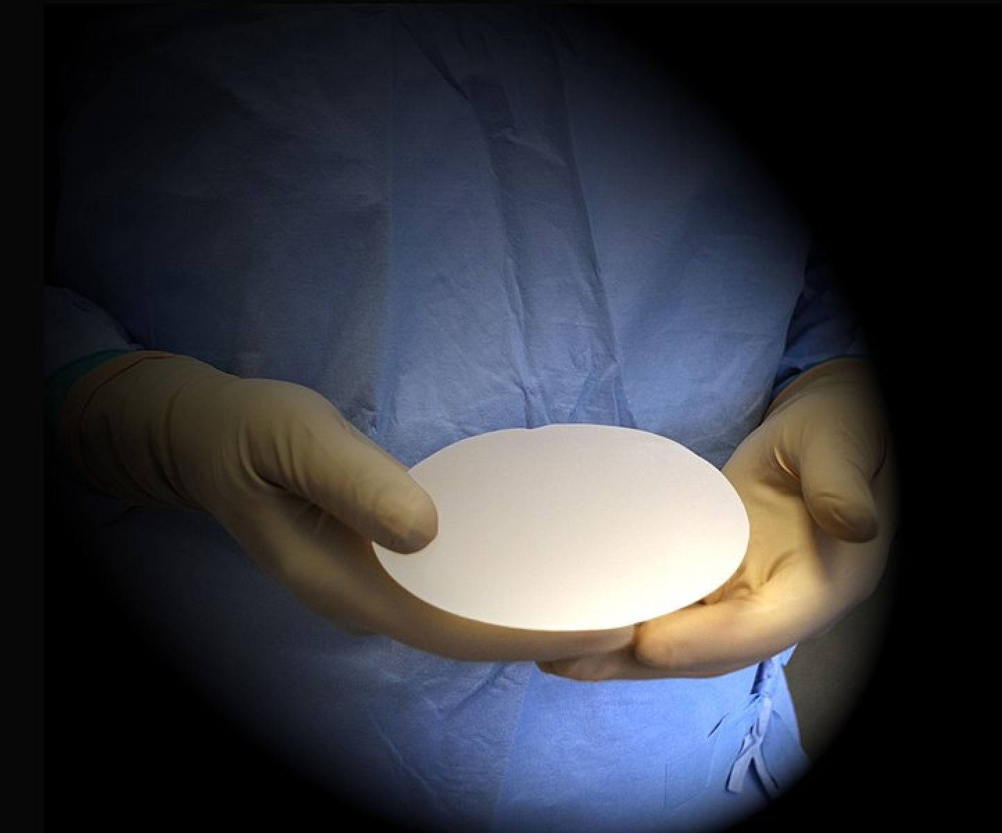 Silicone breast implants: toxicity called into question
