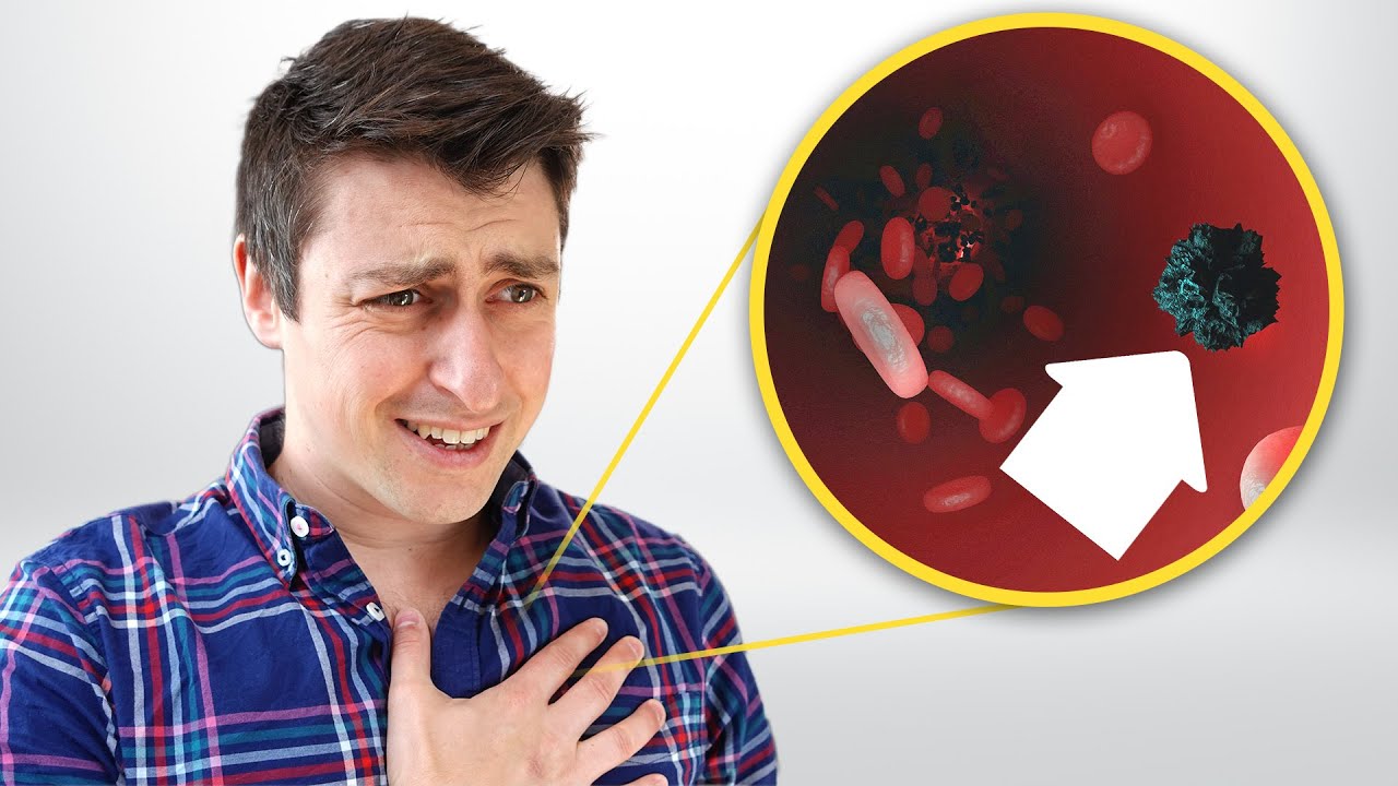 Why air pollution is so scary