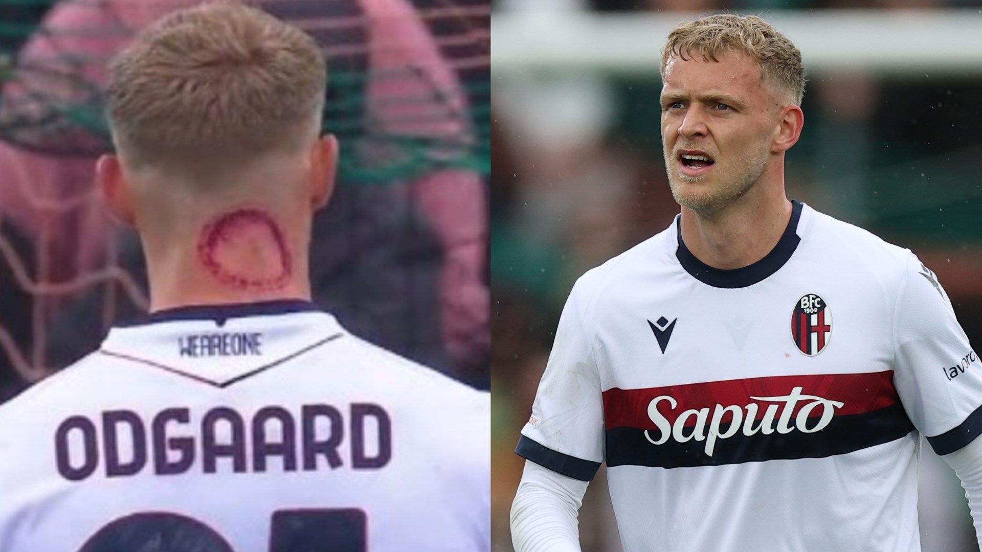 Serie A star forced to explain gruesome red-raw neck 'injury' as fans ...