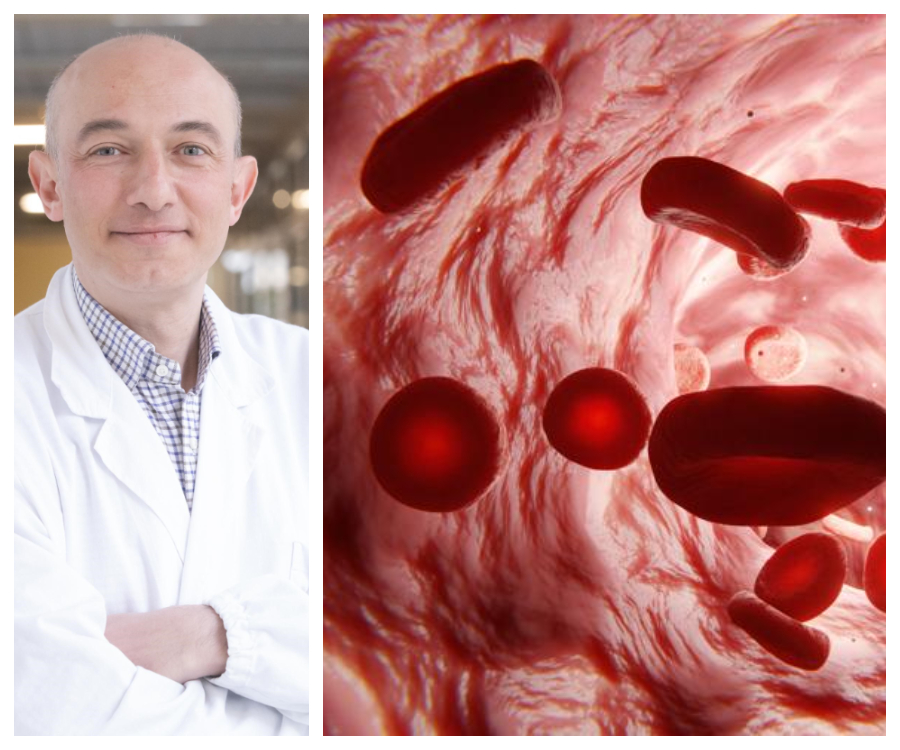 Leucemia acuta mieloide, la scoperta: «Le cellule parlano e si ...