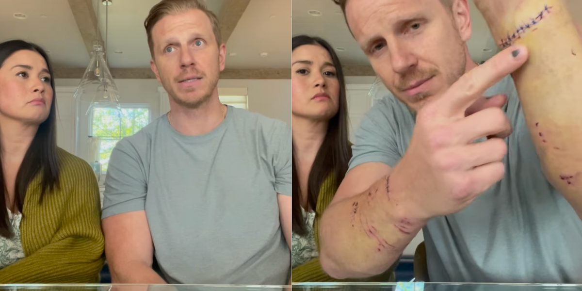 Bachelor Sean Lowe Attacked by Family Dog, Recalls “Pool of Blood” and ...