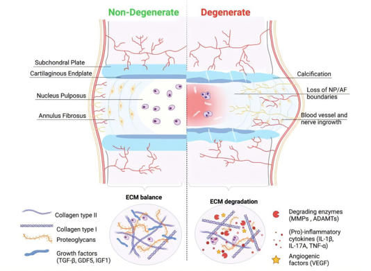 Computational simulator targets intervertebral disk biochemistry to ...