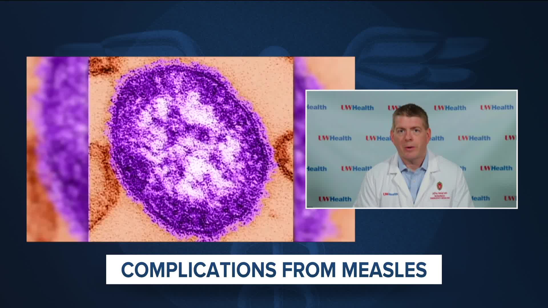 UW Health's Dr. Jeff Pothof discusses complications from measles