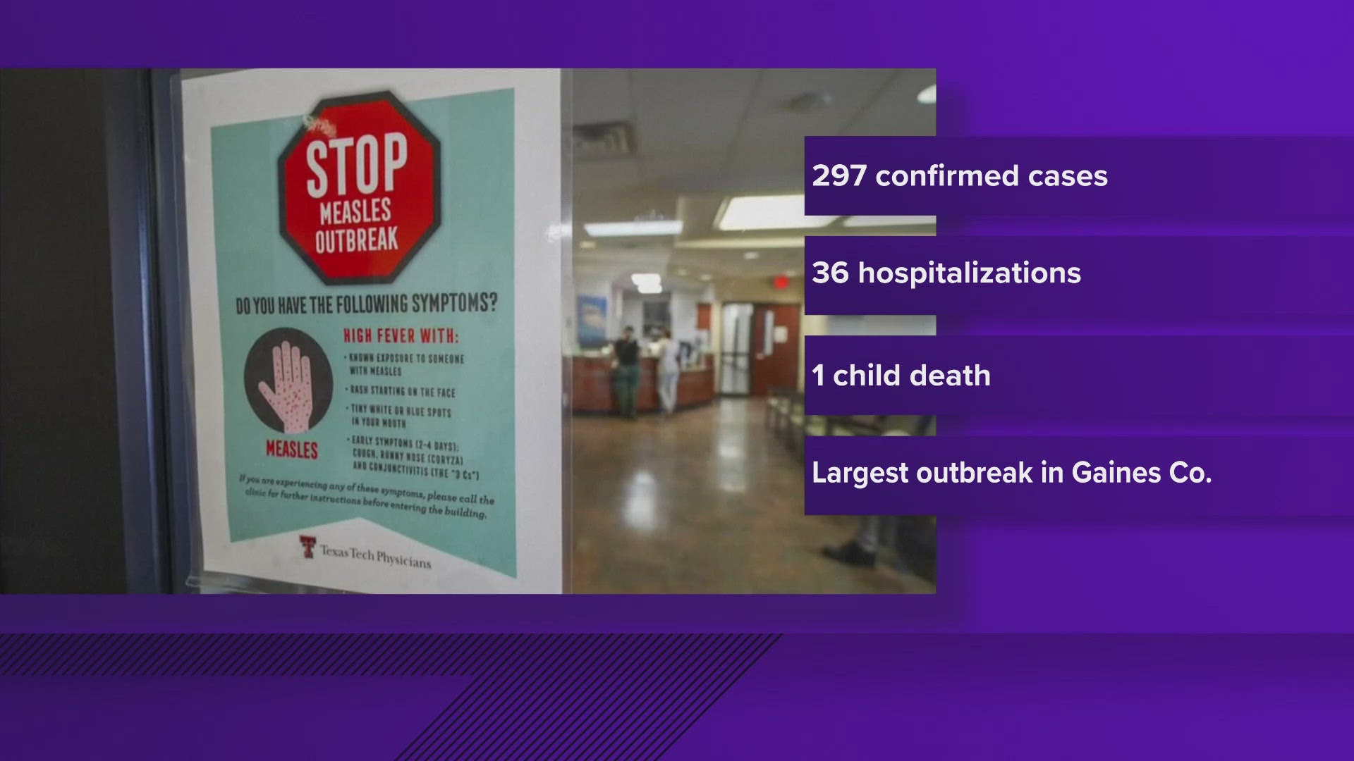 Texas Health Department now reporting nearly 300 measles cases