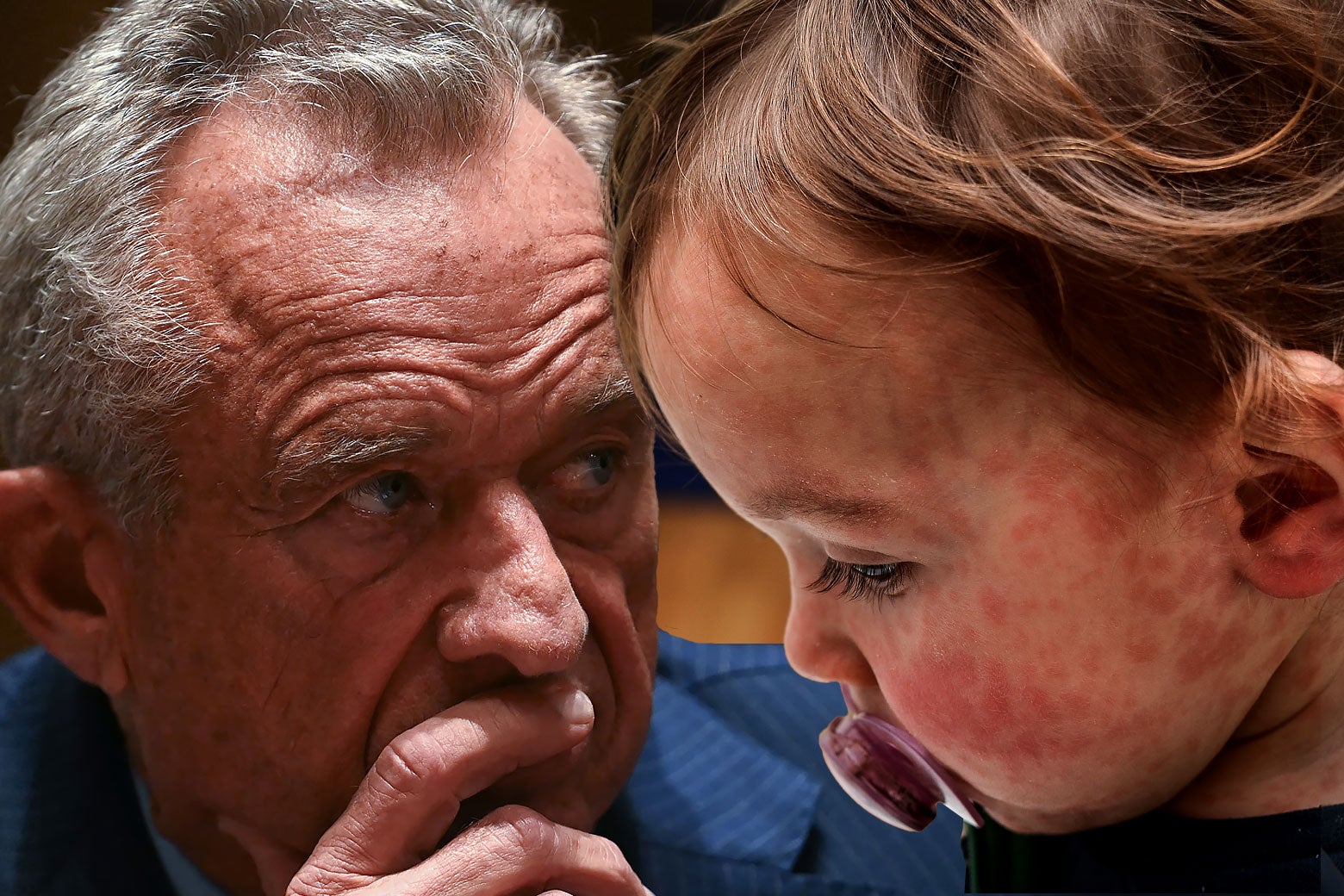 Yes, RFK Jr., Some Studies Suggest That Vitamin A Protects Against ...