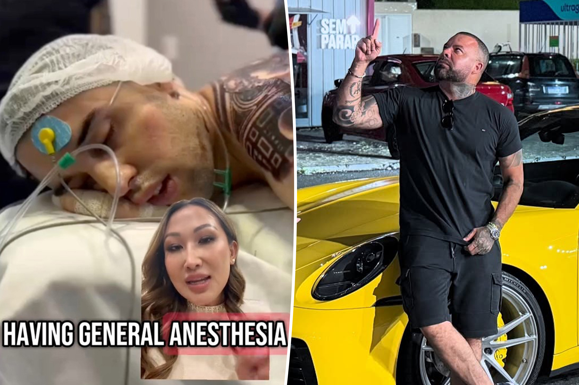 Tattoo fans are getting them done under anesthesia now — here’s why ...