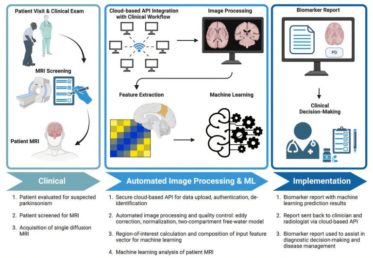 AI-driven software is 96% accurate at diagnosing Parkinson's