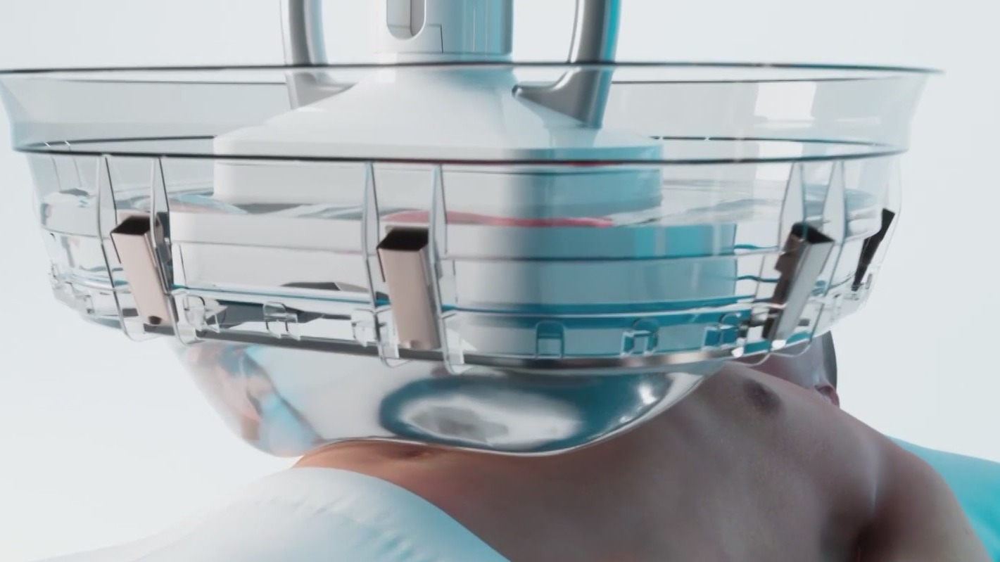 Ultrasound technology offers non-invasive treatment for liver cancer